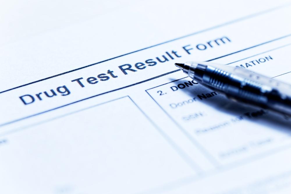 Is a Truck Driver Given a Drug Test if He or She Causes an Accident?